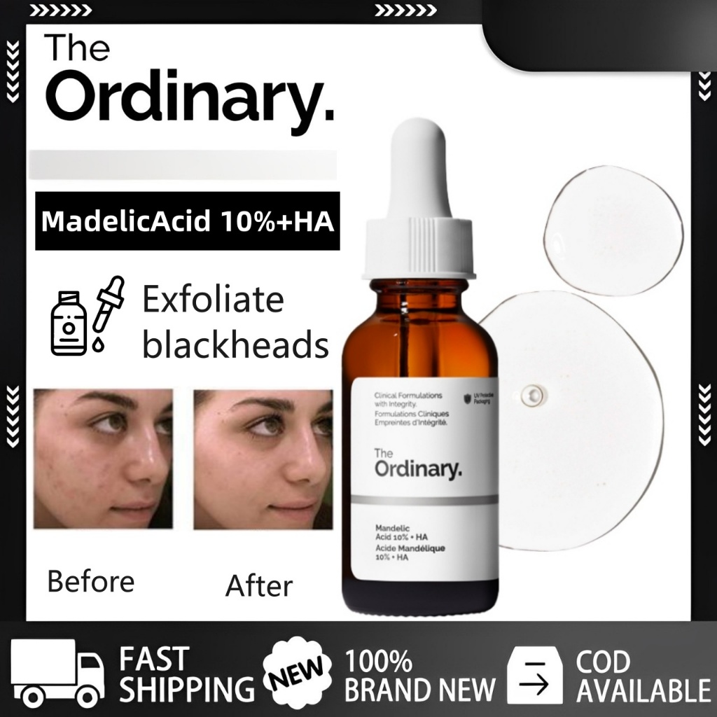 The Ordinary Mandelic Acid 10% + HA 30ml Acne And Pimple blackhead ...