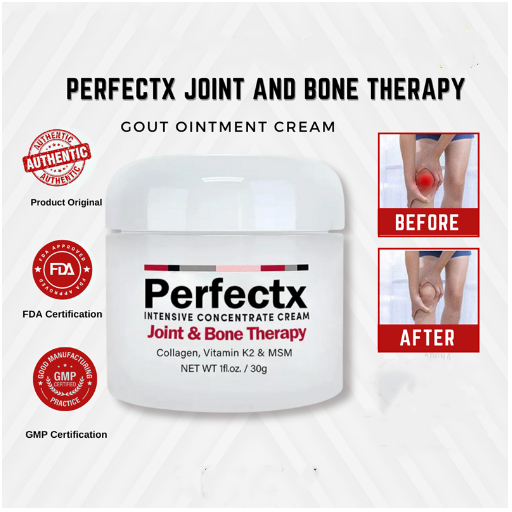 PERFECTX Joint And Bone Therapy Cream 30g Joint Knee Pain Toe Bone Pain ...