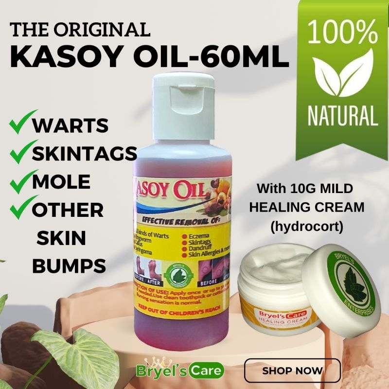 KASOY OIL OR KASOY CREAM AND MORE for WARTS REMOVER, Mole remover ...