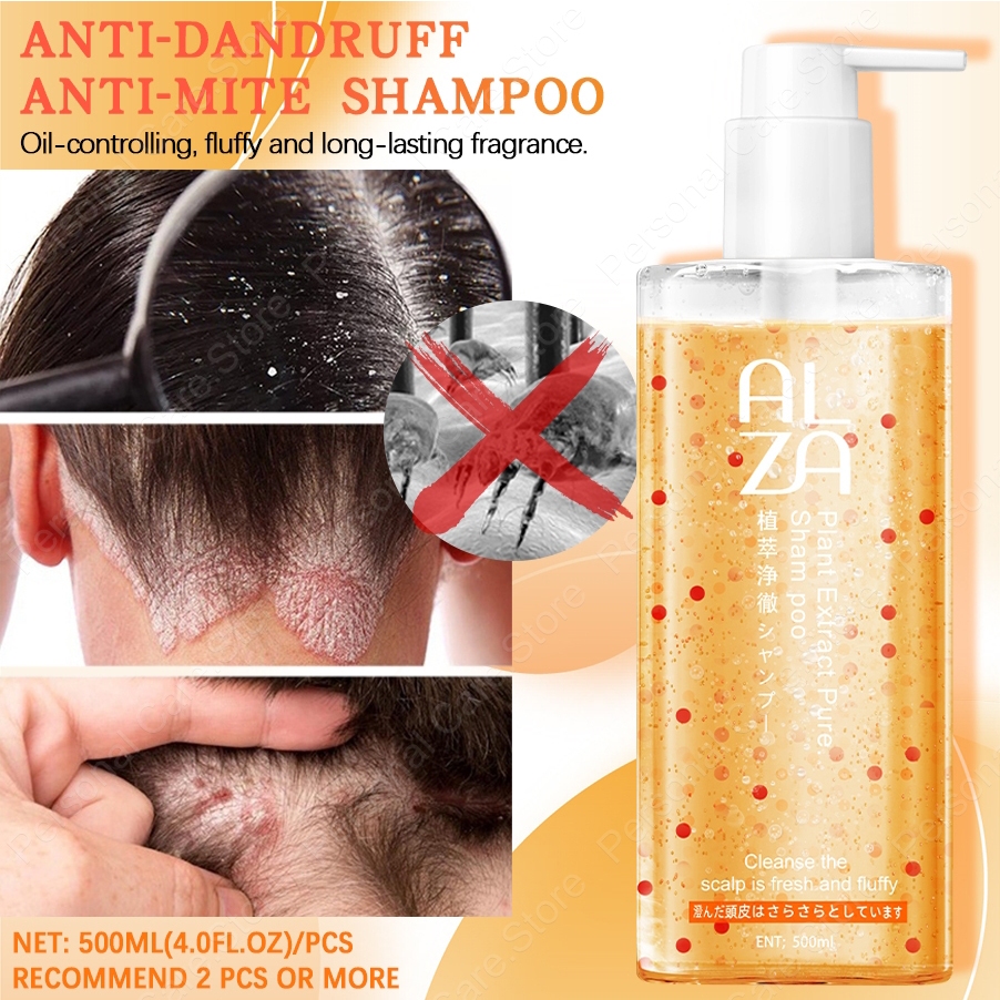 Anti Mite Hair Shampoo Anti Dandruff Anti-itching Oil Control Fluffy Long-lasting Fragrance ...