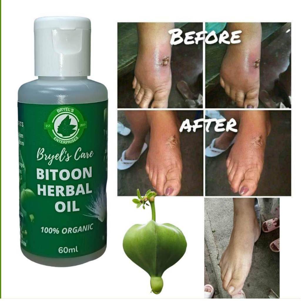 BRYELS CARE 60ML BITOON HERBAL OIL ANTI BODY BUMPS Mabisang Pangtunaw ...