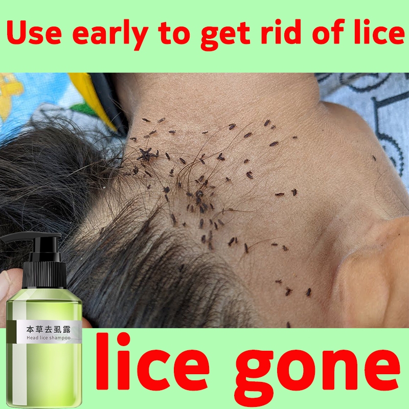 lice removal shampoo for kids free shower and comb anti lice shampoo ...