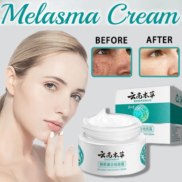Yunnan Herbal Whitening Cream Melasma Cream Japanese Melasma High ...