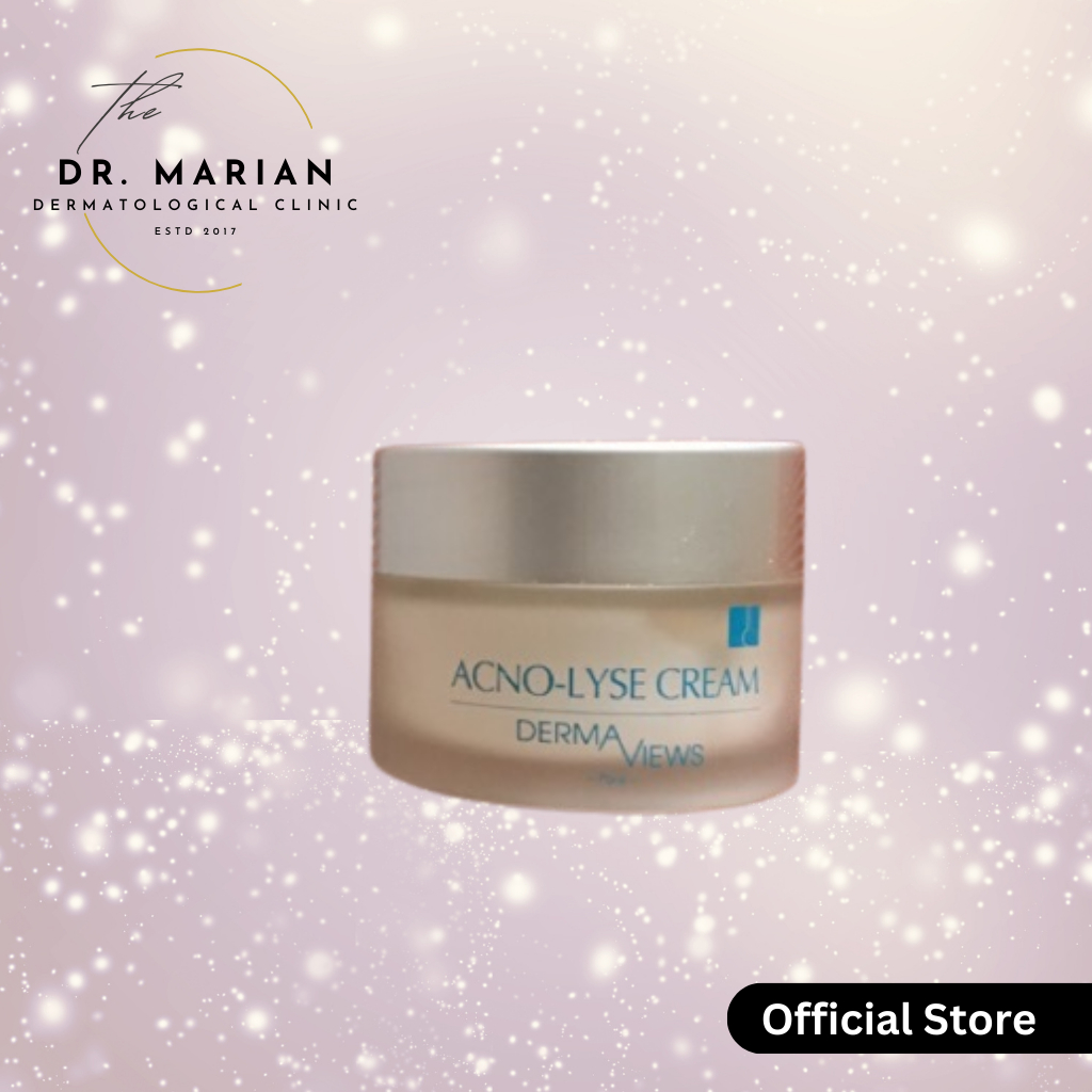 Dermaviews Anti-Acne & Blemish Preventing Acnolyse Cream (30ml ...