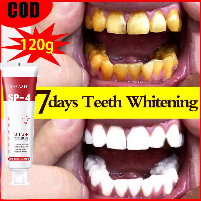SP-4 Probiotic Whitening Toothpaste Improve Yellow Tooth Stain Fresh ...