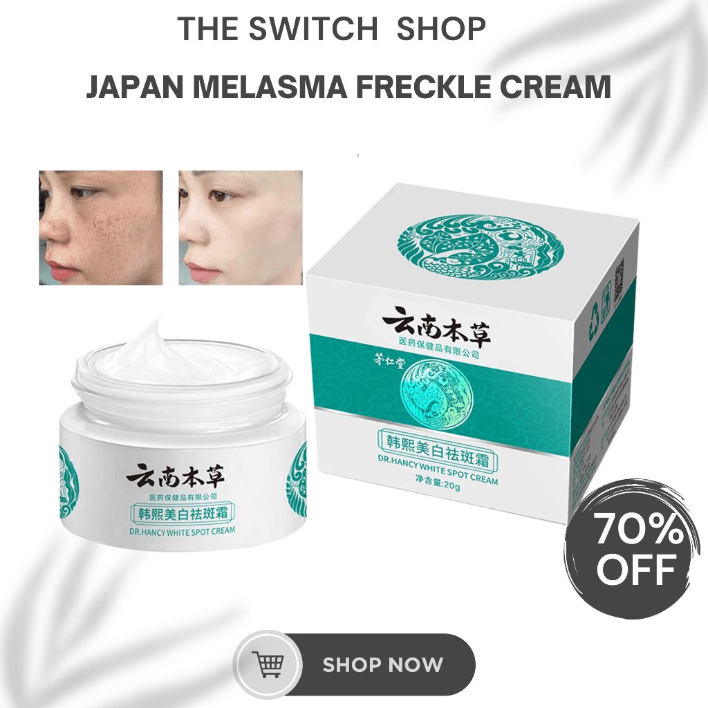 Japanese Melasma Cream - Skin Care Treatment for Melasma and Dark Spots ...