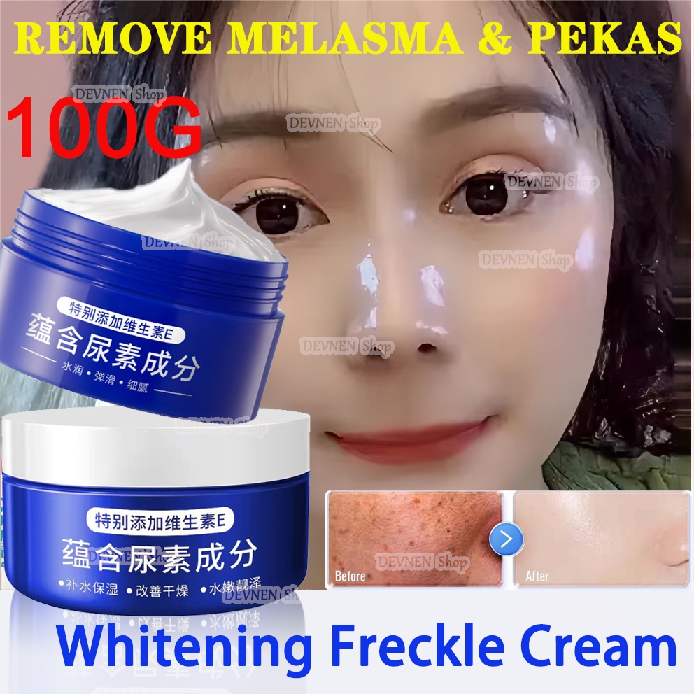 Pekas Cream Victamin E Moisturizer Remove Melasma Whitening Skin ...