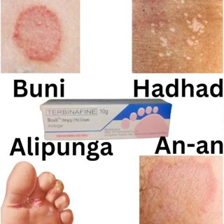 Terbinafine Noali Anti-fungal Cream Effective for Buni, An-an, Hadhad ...