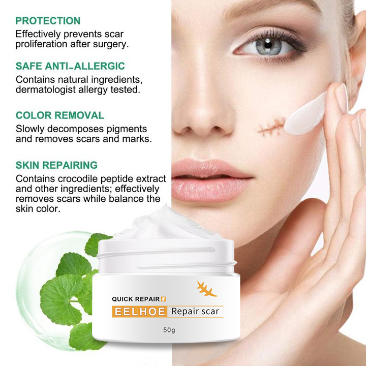 Scar Remover Cream Mosquito Bite Scar Remover Removal Keloid Old Scar