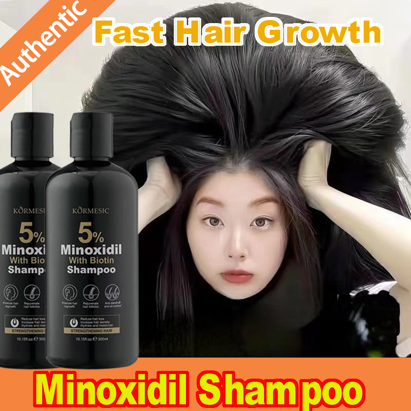 Minoxidil 5% Hair Grower Shampoo With Biotin For Hair Loss Treatment Fast Hair Grower 300ml ...