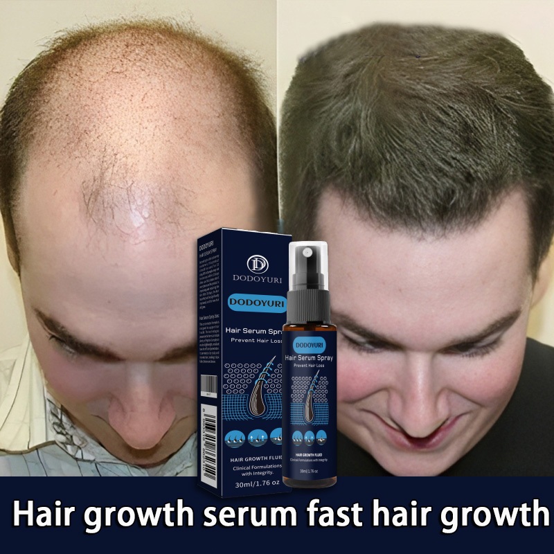 Hair growth serum fast hair growth hair grower for man Spray Hair ...