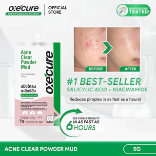 oxecure - Best Prices and Online Promos - Oct 2025 | Shopee Philippines