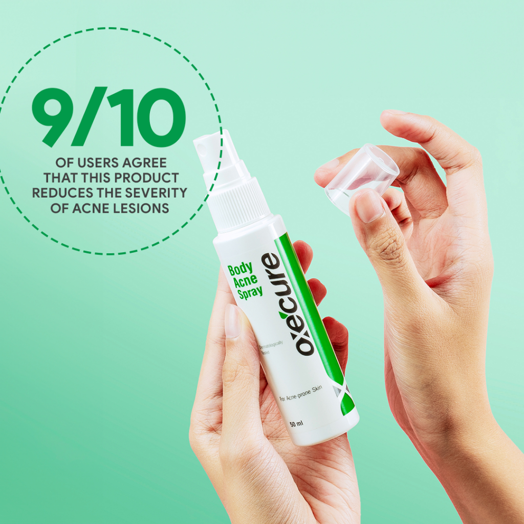 OXECURE 2% Salicylic Acid Body Acne Spray 50ml | Shopee Philippines