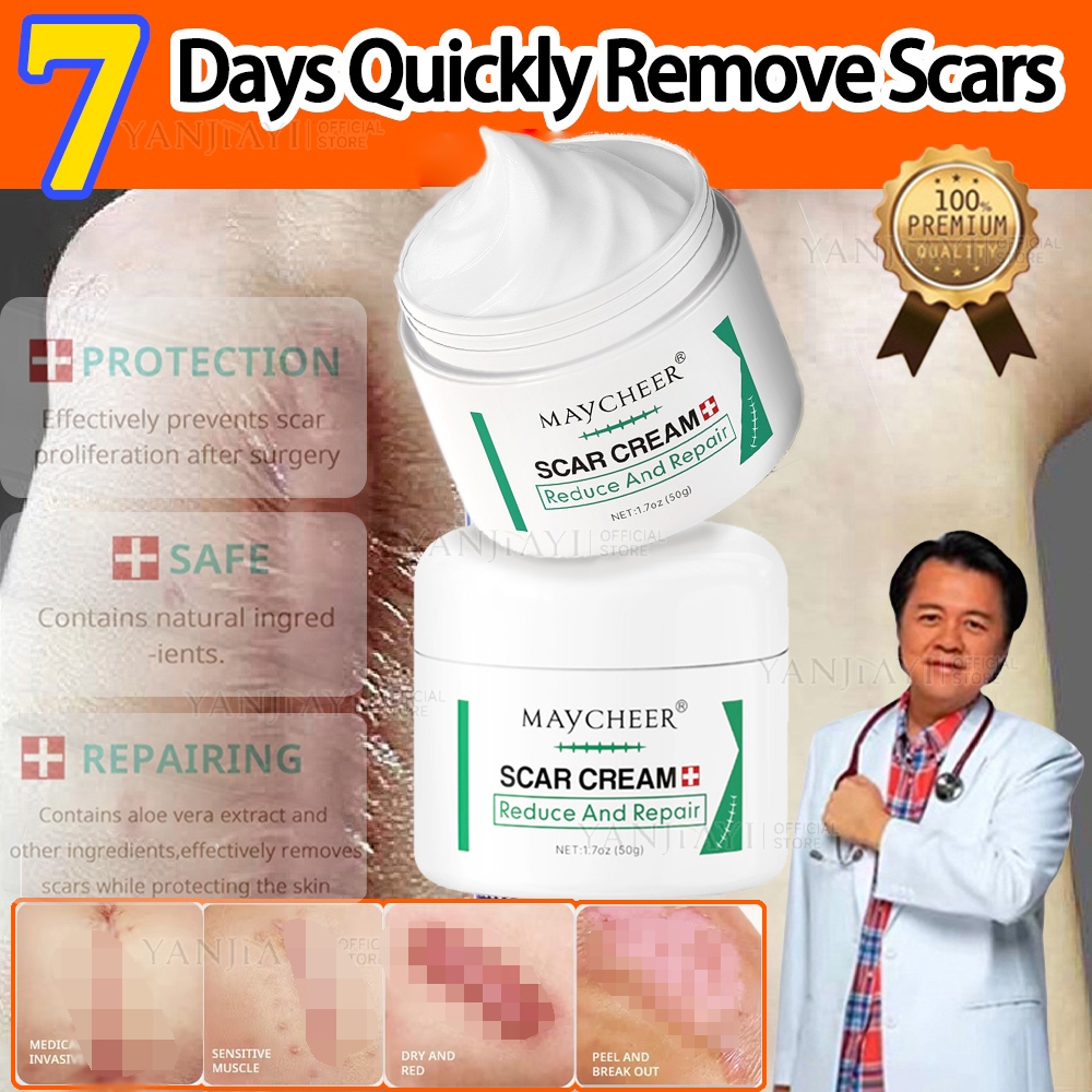 YANJIAYI Effective Old Scar Remover for Legs Peklat Remover Acne ...