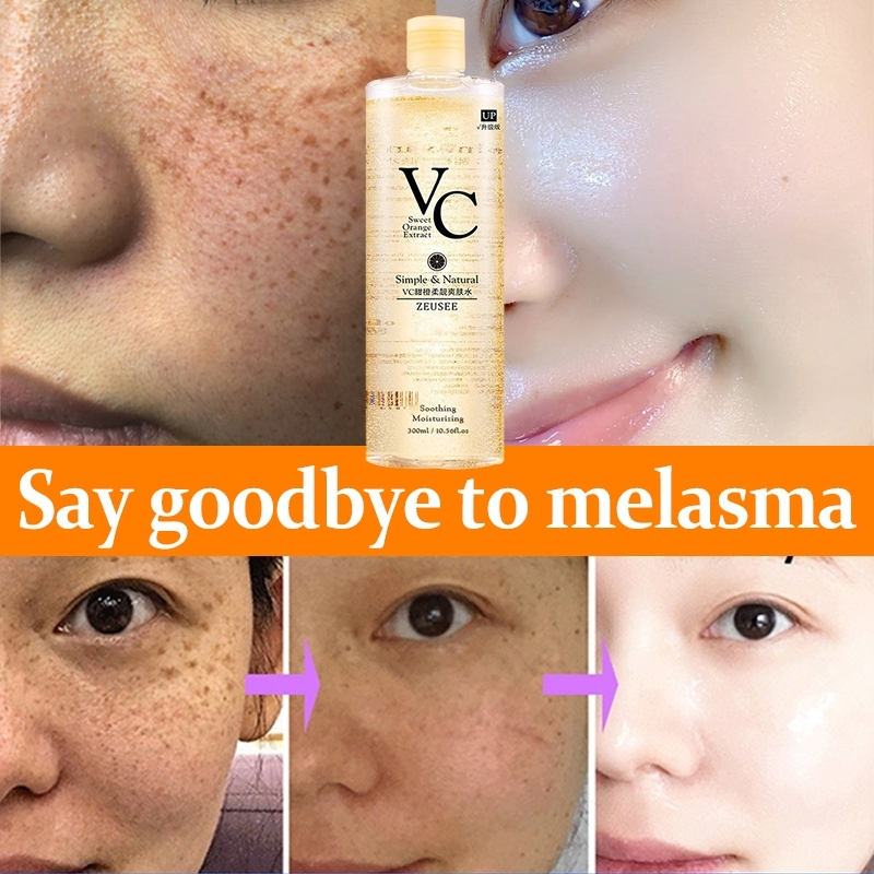 VC Toner Whitening Vitamin C Orange Peeling Toner Remove Melasma 300ML ...