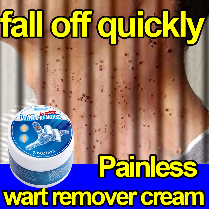 Warts Removal Original Cream Kulugo Skin Tags Mole Remover Genital Flat ...