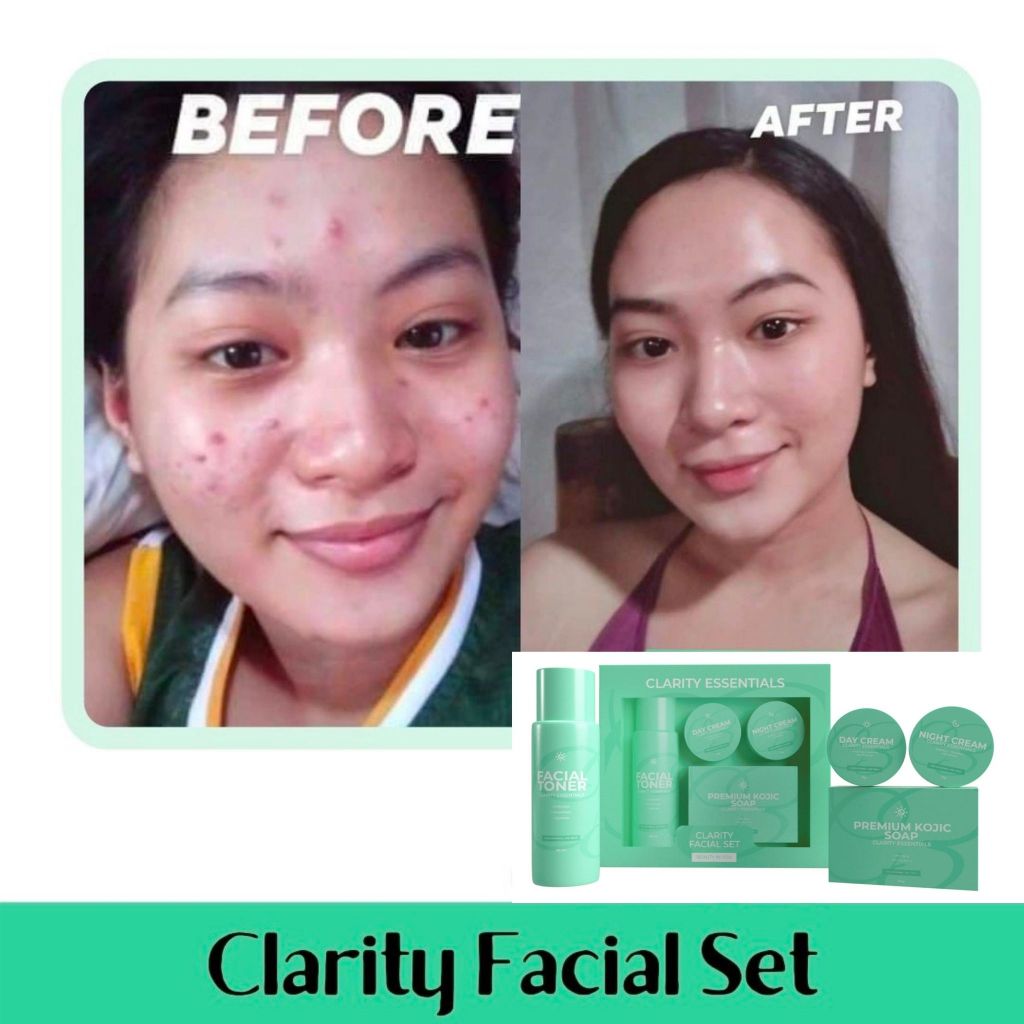 FDA Approved Clarity Facial Set - Facial Set | Shopee Philippines