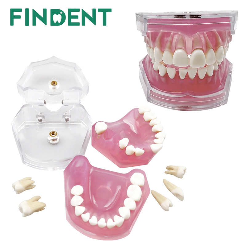 Dental Implant Teeth Model Study Teach Standard Model with Removable ...
