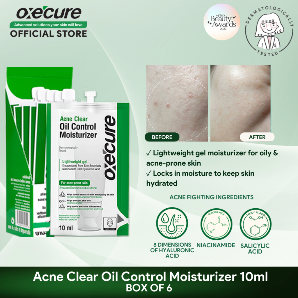 OXECURE Acne Clear Oil Control Moisturizer 10ml Box of 6 | Shopee ...