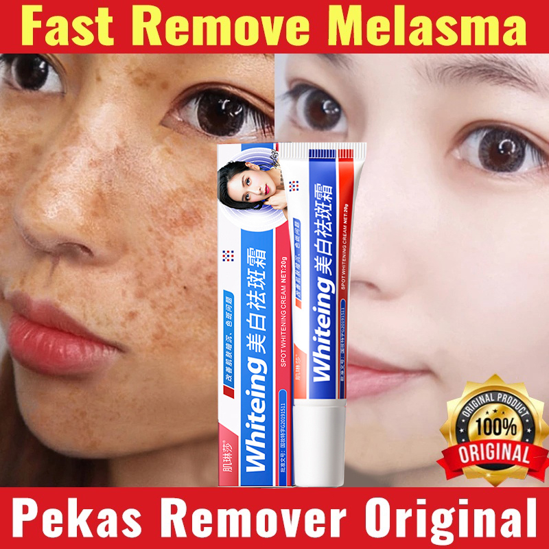 Pekas Remover Effective Melasma Cream Anti Freckle Collagen Original ...