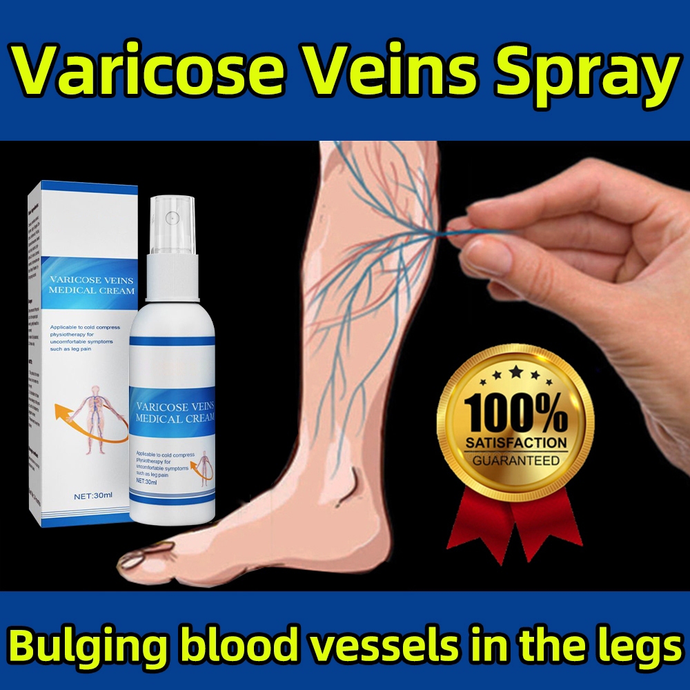 Varicose Vein Remover Spray Spider Vein Pain Killer Cream Cure ...