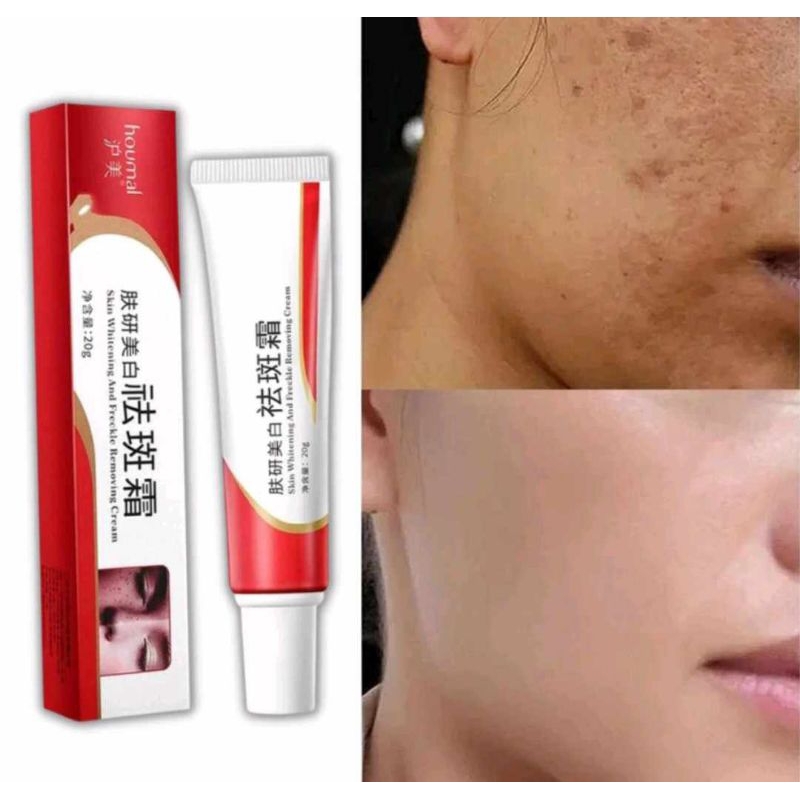 EFFECTIVE MELASMA CREAM PEKAS REMOVER SKIN WHITENING MOISTURIZER ANTI ...
