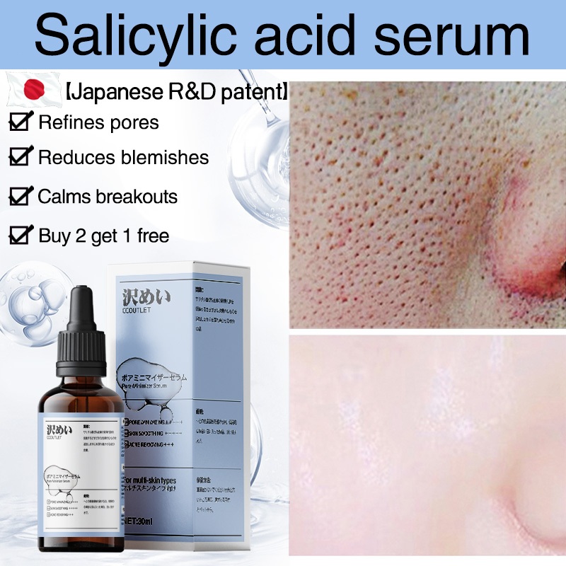 C C Outlet Salicylic Acid Serum Pore Minimizer Anti Acne Spot Scars ...