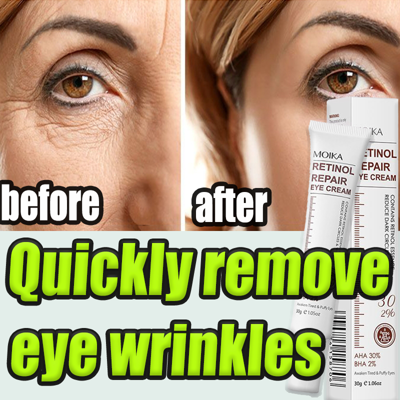 Moika Retinol Eye Cream Eye Anti-Aging Reduce Wrinkles Around Eyes Eye ...