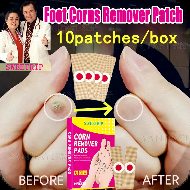 SWEETRIP 10pcs Foot Corns Remover Patch Warts Remover Pads Remove ...