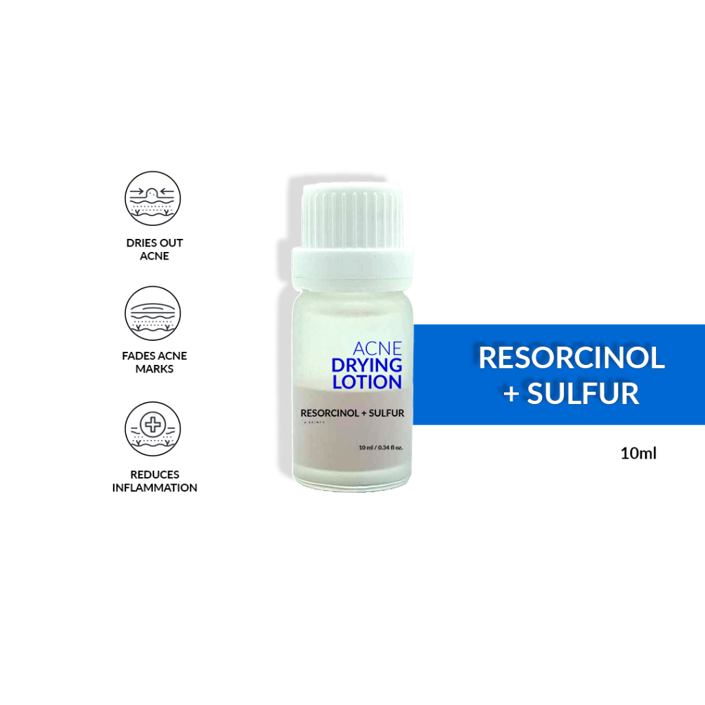 Resorcinol + Sulfur SkinFX Acne Drying Lotion | Shopee Philippines
