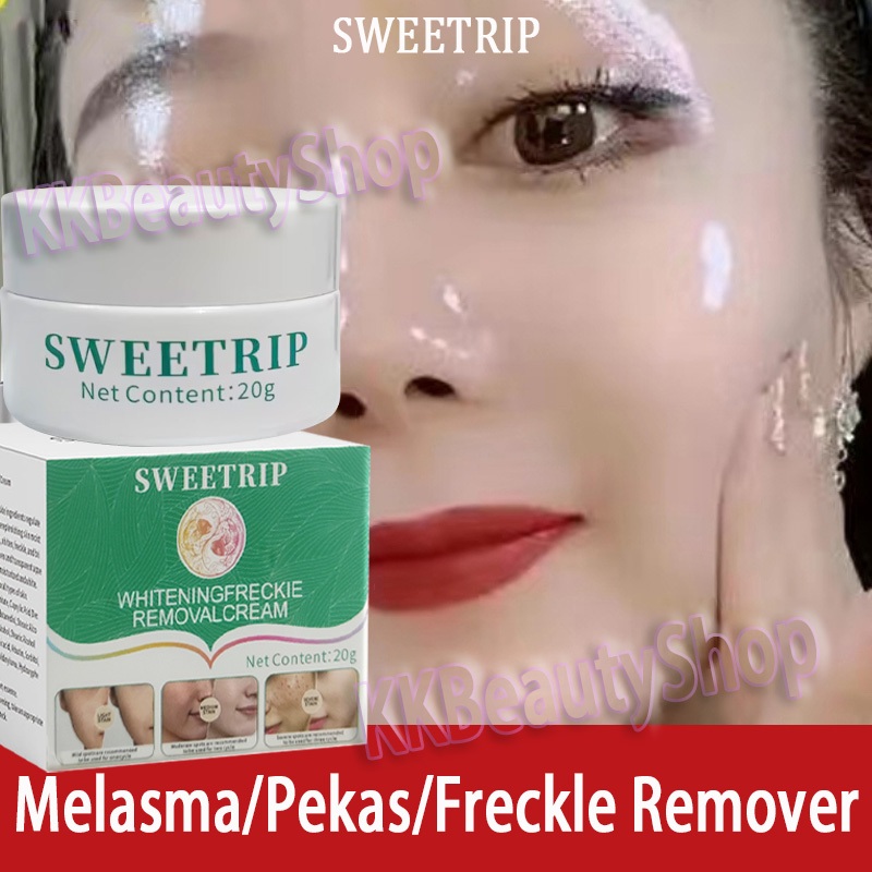 SWEETRIP Pekas Remover Melasma Cream Whitening Freckle Cream Brighten ...