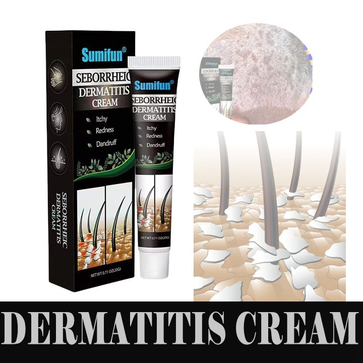 Original Anti-Dandruff Cream for scalp psoriasis Anti-Dandruff ...