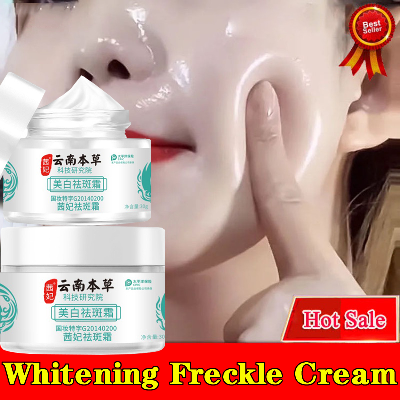Melasma Cream Pekas Remover Original Freckle Cream Dark Spots Remover ...