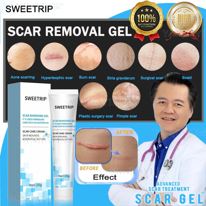 SWEETRIP Scar Cream Peklat Remover Scar Repairing Acne Scars Treatment ...