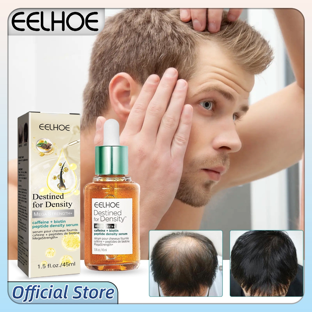 Eelhoe Hair Regrowth Serum 45ml Prevent Hairs Loss Improve Hair ...