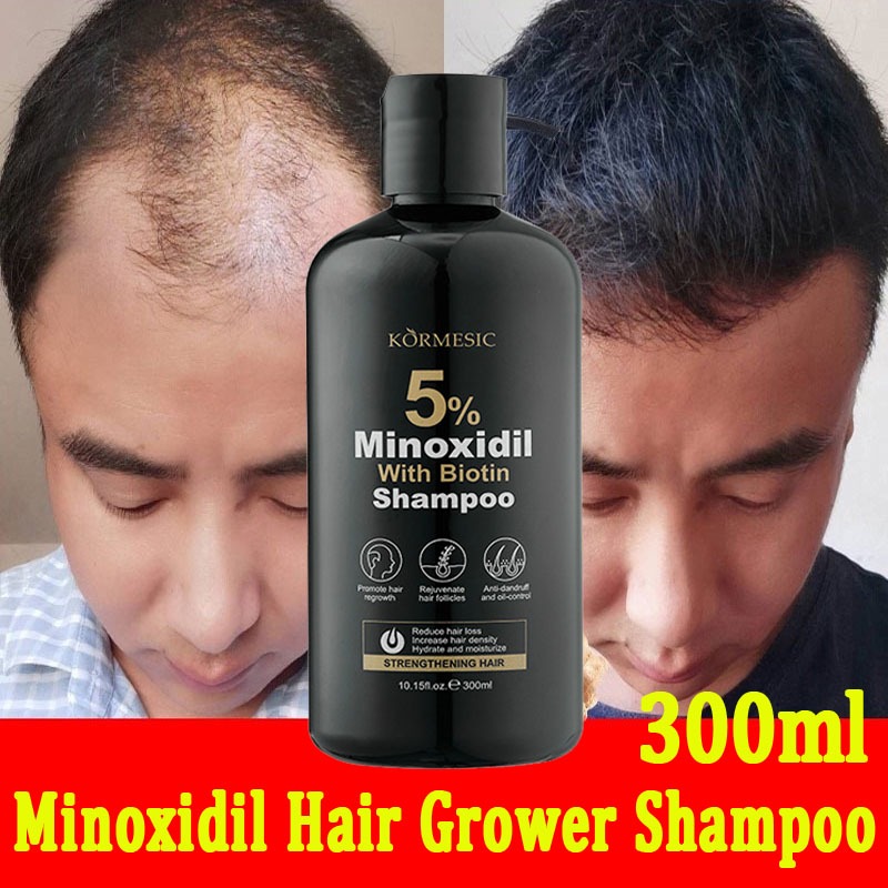 300ML Hair Grower Shampoo with Minoxidil Biotin Hair Growth Anti Hair ...