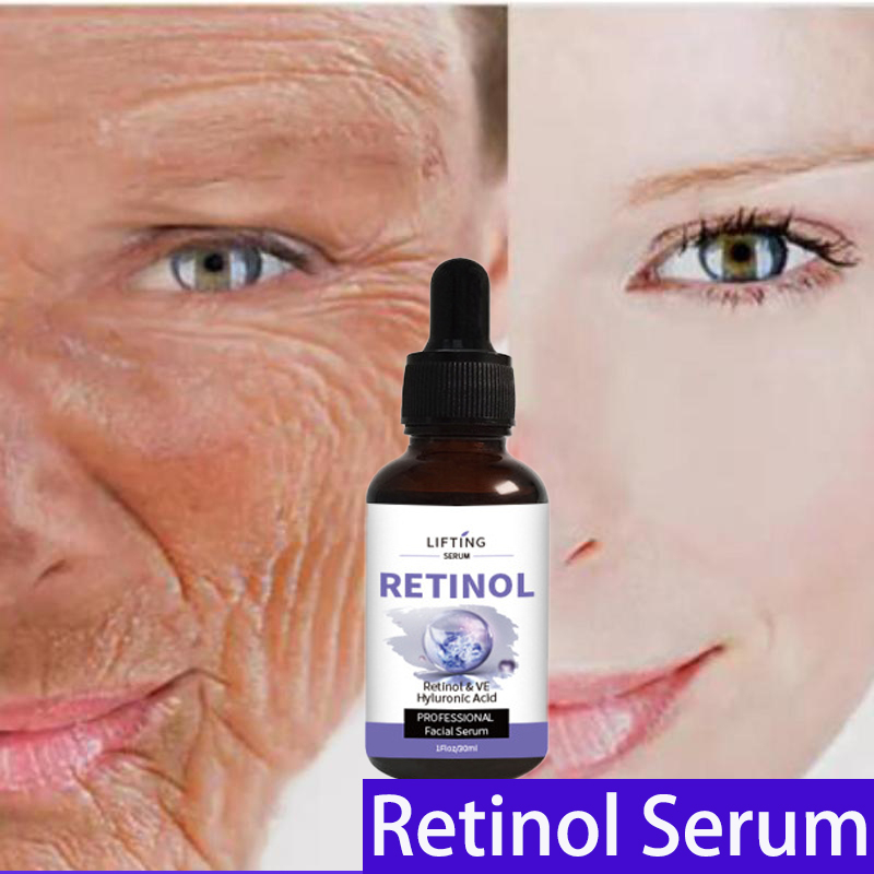 Retinol Facial Serum Anti-Aging Anti Wrinkle Whitening Skin Acne ...