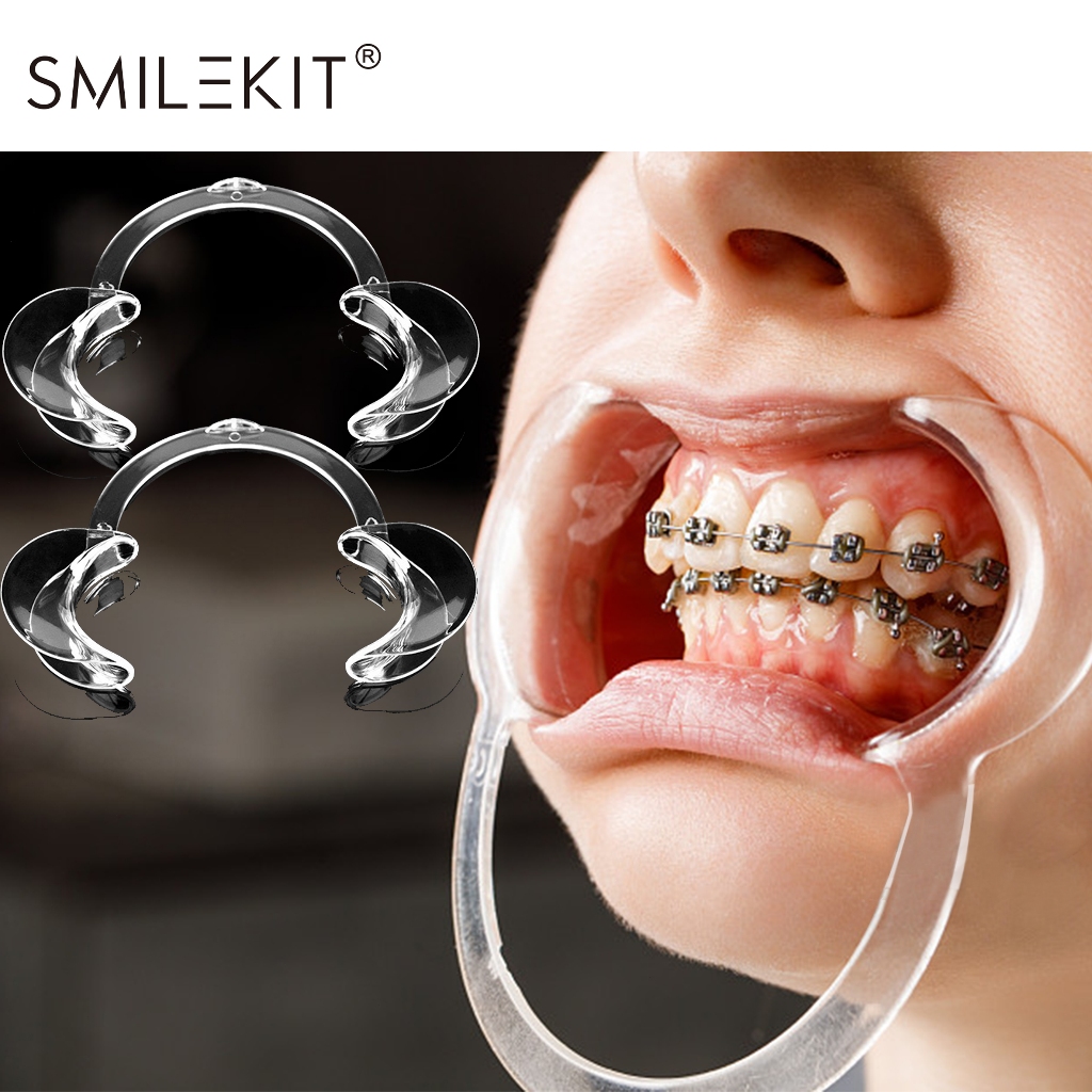 SMILEKIT Mouth Retractor Cheek Retractor Dental Mouth Opener Teeth ...