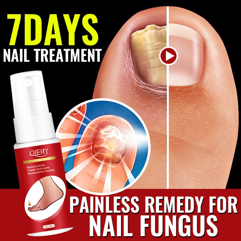 RtopR Ginger Antibacterial Nail Treatment Essential Anti Fungal ...