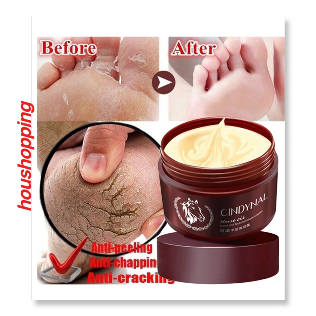 110g Horse Oil Callus Remover Foot Care Cream For Cracks And Dry ...