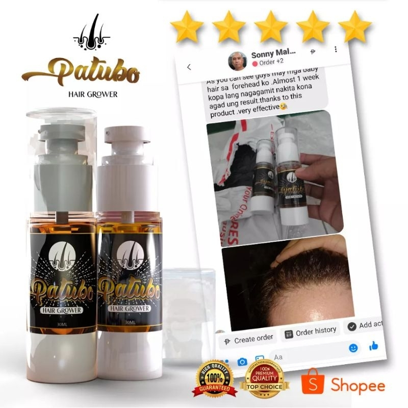 Tubo Hair Growth Authentic Effective Patubo Hair Grower Minoxidil PampaTubo ng Buhok Pampa Lago ...