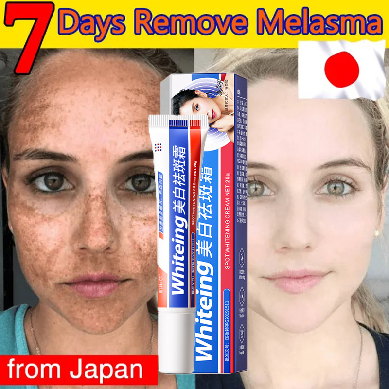 100% Pekas Remover Effective Melasma Cream Anti Freckle Collagen ...