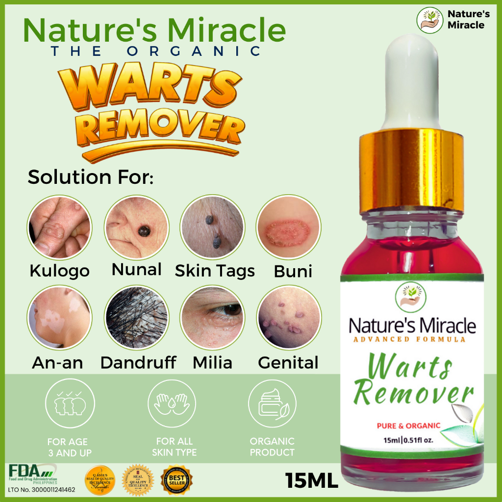 Warts Remover Kasoy Oil 15ML Nature s Miracle Warts Remover Mole ...