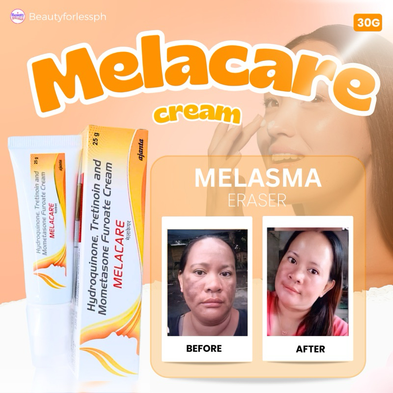 AUTHENTIC MelaCare Cream 25g Anti Melasma Cream Skin Whitening Face ...