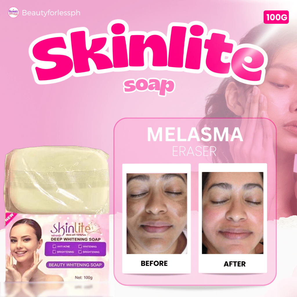 AUTHENTIC Skinlite Beauty Whitening Soap Pekas Remover Melasma Remover ...