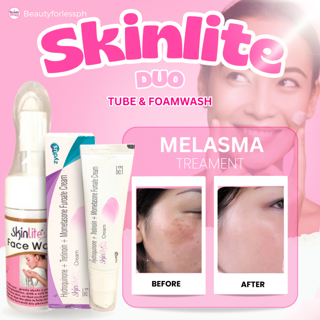AUTHENTIC SKINLITE Facial Foam Wash and Cream COMBO Melasma Cream Pekas ...