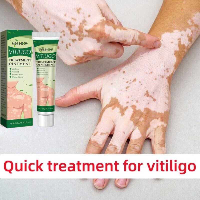 20g Leukoplakia Disease Treatment Ointment White Spot Disease Repair ...
