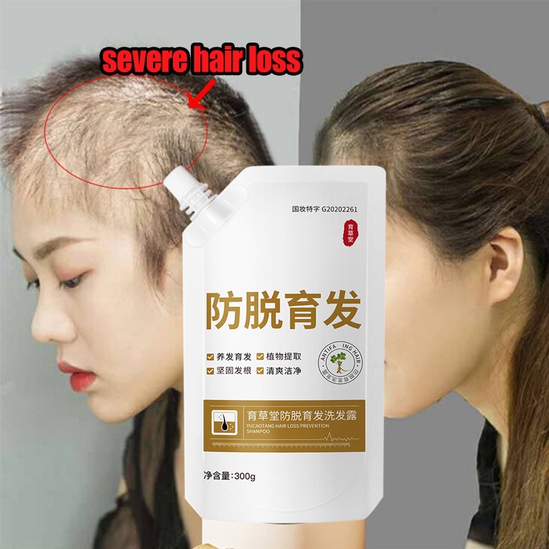 300g Hair Growth Anti Dandruff Shampoo Thick Anti Hair Loss Fast Regrowth Hair Herbal Ginger