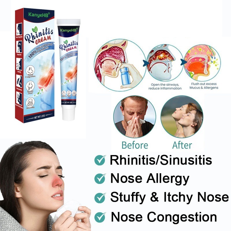 Allergic Rhinitis Ointment Sinusitis Spray Improve Rhinitis Ointment ...