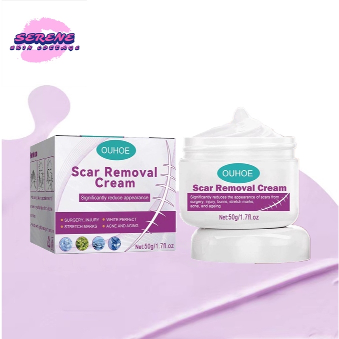 Scar Removal Cream Peklat Remover Acne Treatment Scar Remover Cream ...